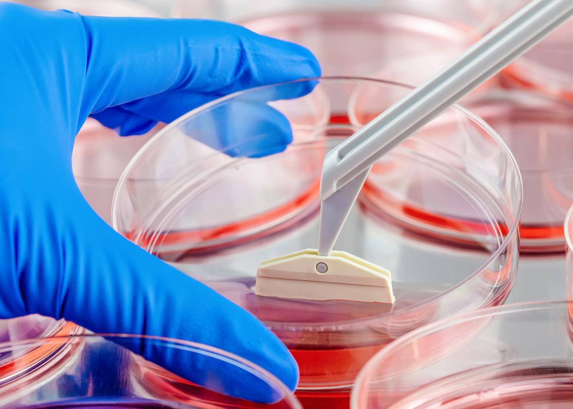 The Impostor Cell Line That Set Back Breast Cancer Research The Impostor Cell Line That Set Back Breast Cancer Research