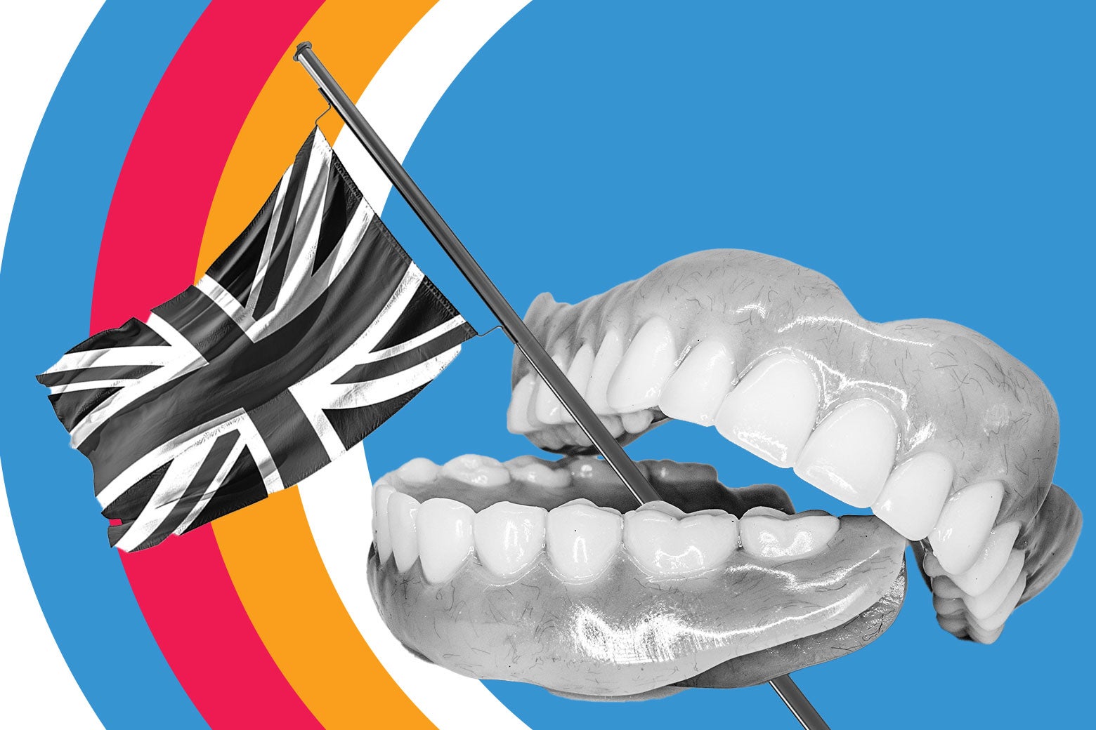 Is the bad British teeth trope based in reality?