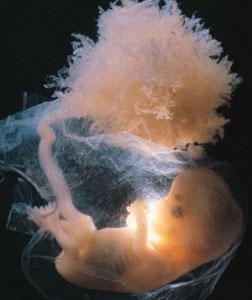 Screening embryos for eye, hair, and skin color.