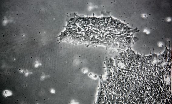 Researchers Turn Living Cells Into Logic Gates, Moving Toward Cell Circuits