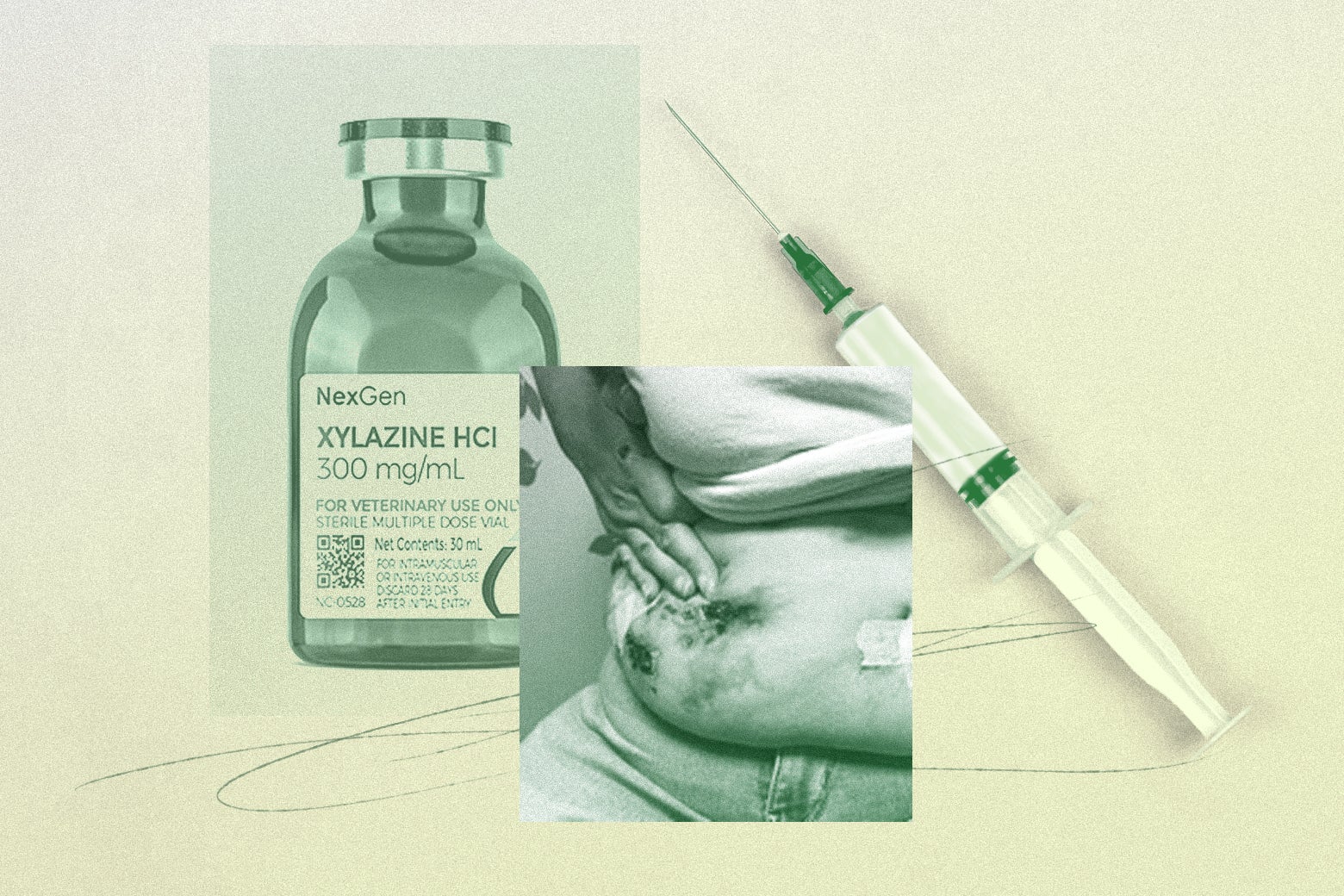 Tranq: What to know about the “zombie drug.”