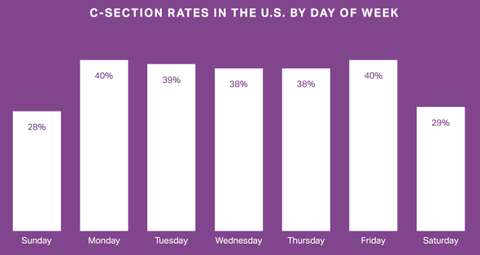 Where C-sections are most common in the U.S. and why they're performed.