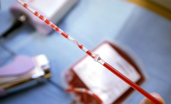 Jehovah’s Witness blood transfusions: How a doctor works around doctrine.