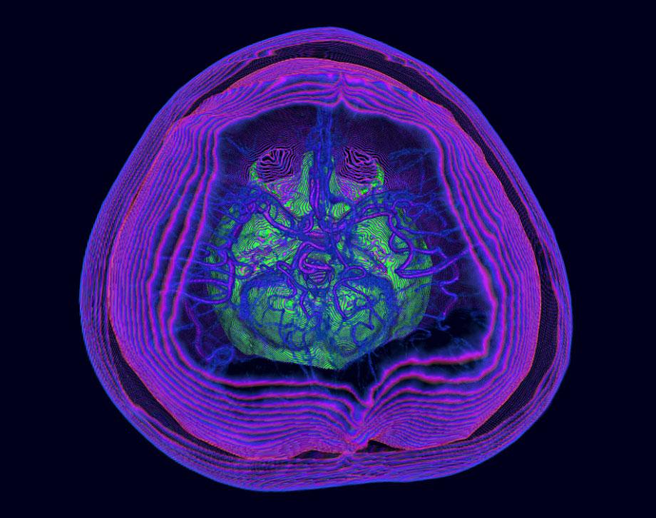 Dr. Kai-hung Fung: Using CT scans of the human body to create fine art ...