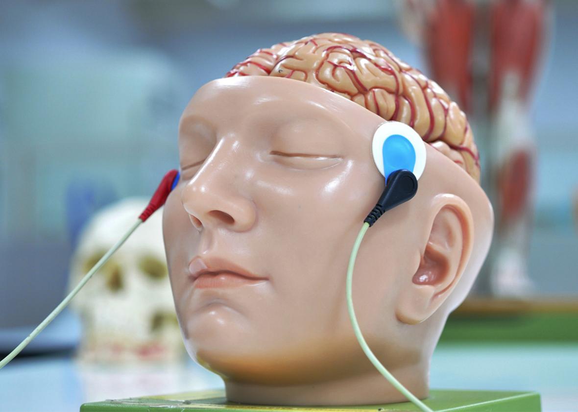 Schizophrenia and subvocal speech: Why people with schizophrenia hear ...