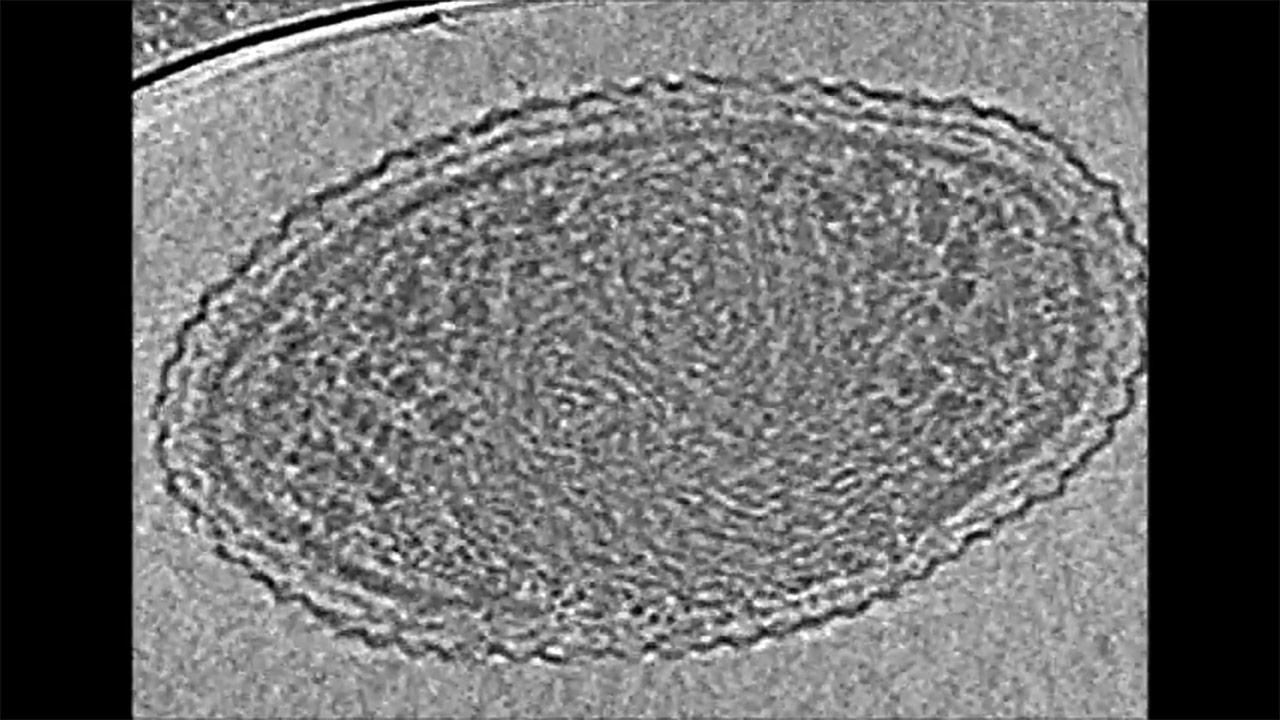 Smallest life on Earth: nano-scaled bacteria observed in Colorado ...