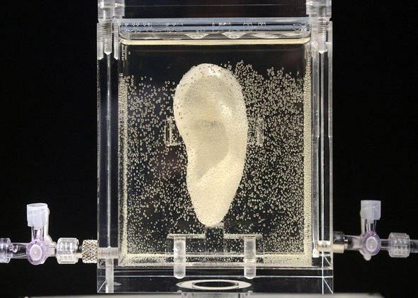 Living replica of Van Gogh’s ear: Vincent’s family member provides DNA ...