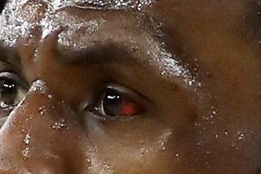 LeBron James' left eye looks very red and gross.