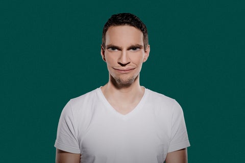 Demon face syndrome: What it’s like to have the rare disorder.