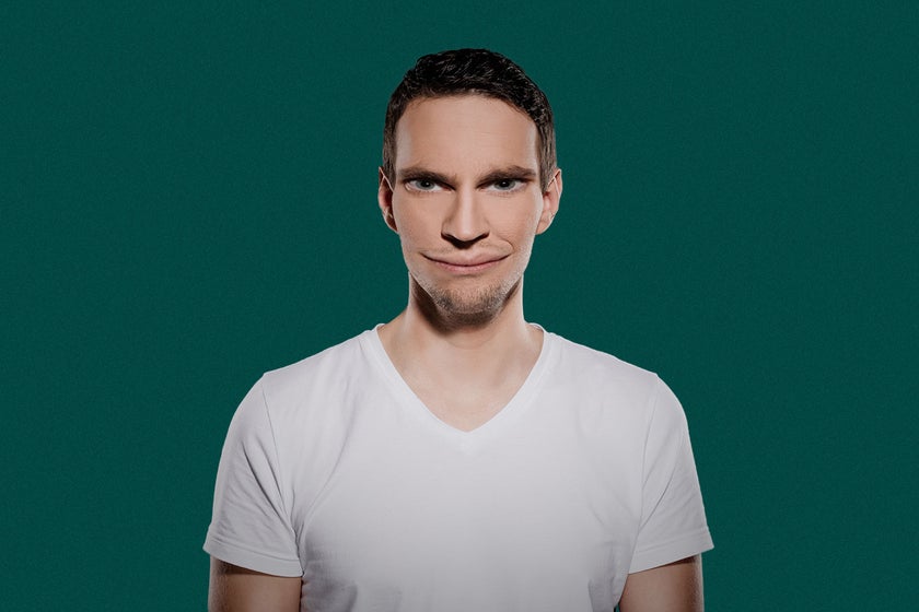 Demon face syndrome: What it’s like to have the rare disorder.