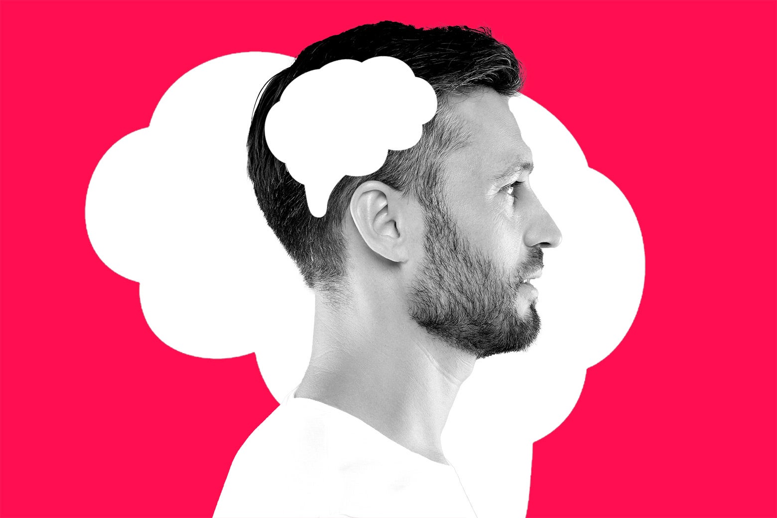 Dear Prudence: My husband forgets every single appointment I make