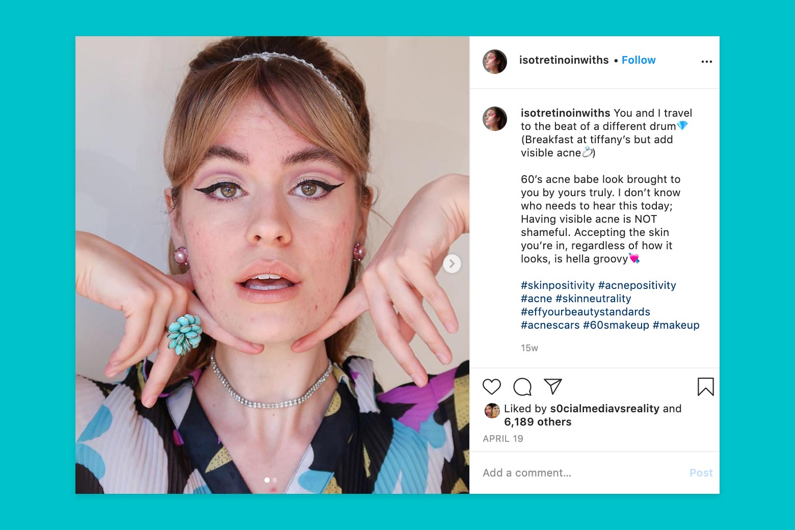 Acne positivity: How brands are finally showing off pimples.