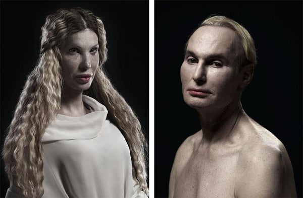 Phillip Toledano: “A New Kind of Beauty” examines people who redefine ...