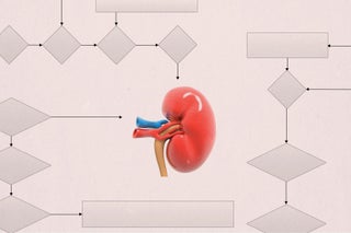 Kidney allocation algorithm: a lesson in A.I.