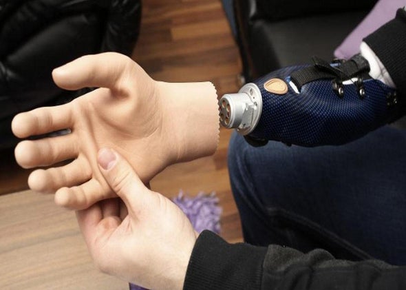 Bionic arms and elective amputation: Latest on mind-controlled limbs ...