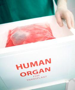 Israel's remarkable new steps to solve its organ shortage.
