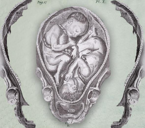 Personhood movement, chimeras: How biology complicates politics.
