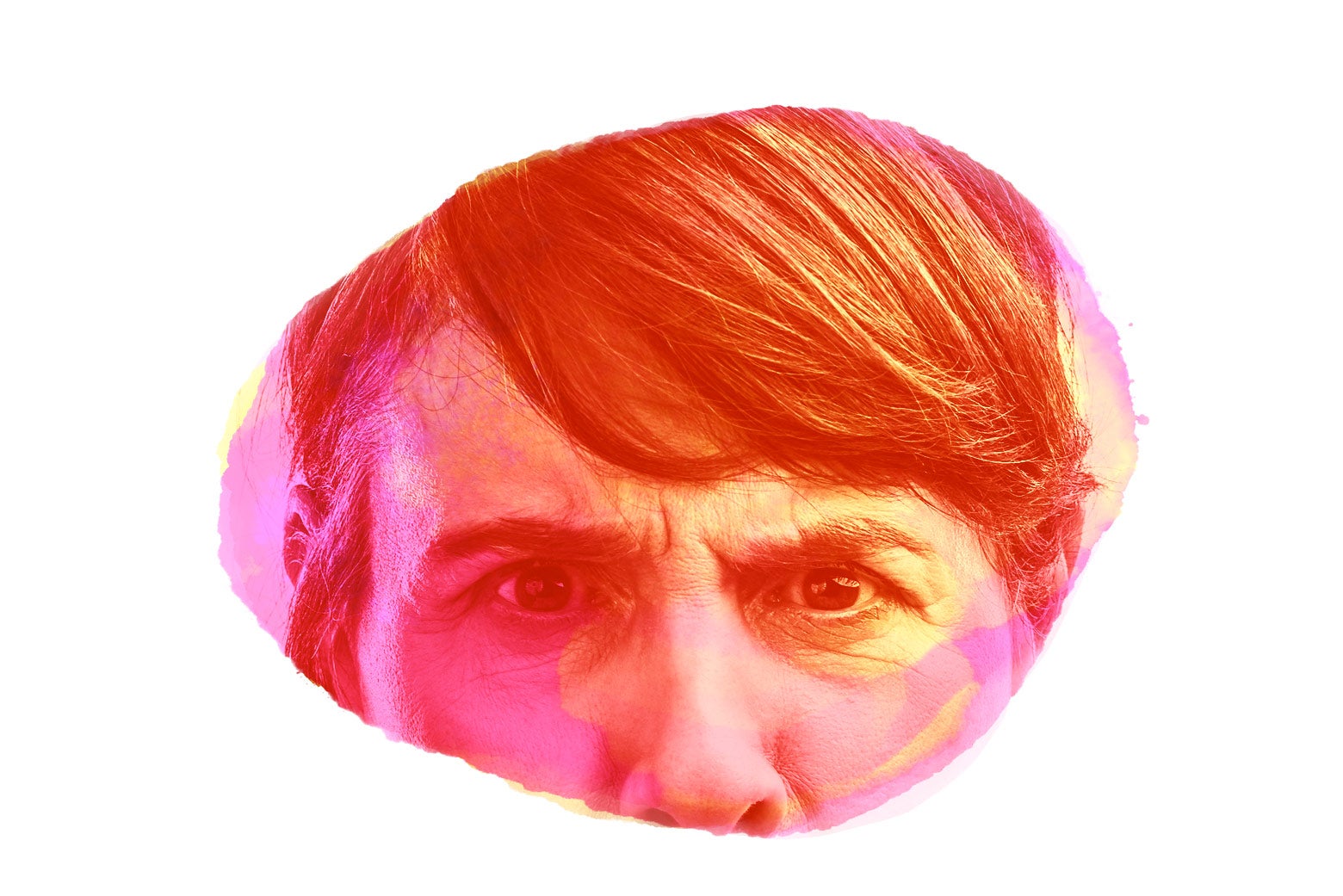 Precisis Gmbh: Easee - ­­­World'S First Minimally Invasive Brain ...