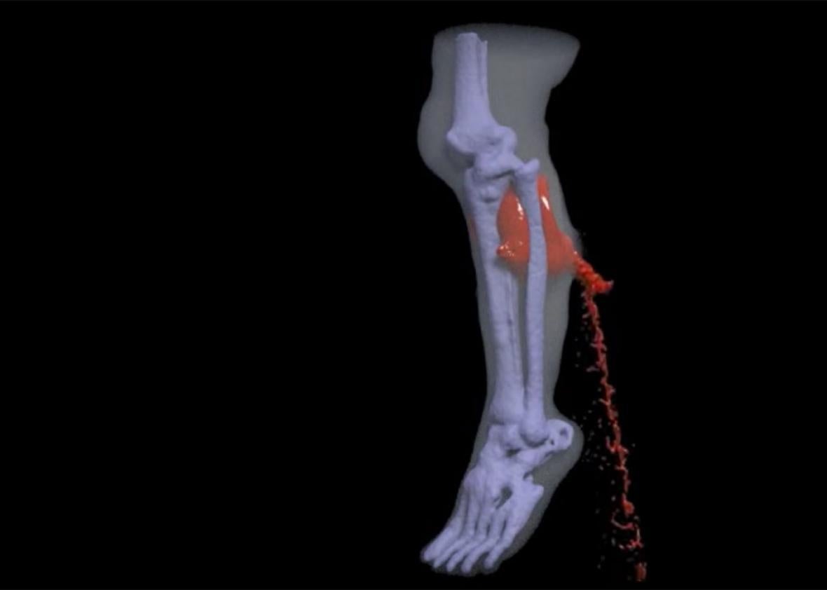 Simulation shows how wounds bleed in real time (VIDEO).